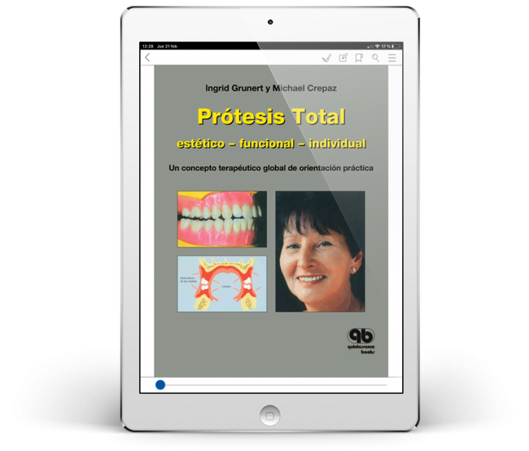 Prótesis Total - Quintessence Digital